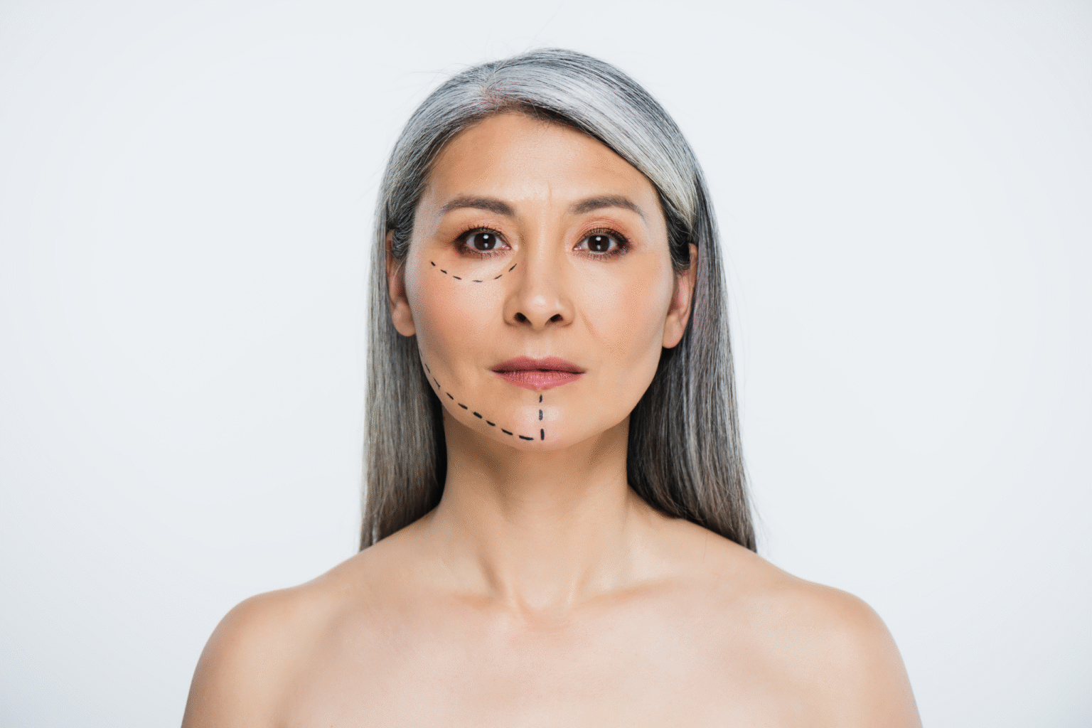 Non-Surgical Face Lift | Natural Facial Rejuvenation